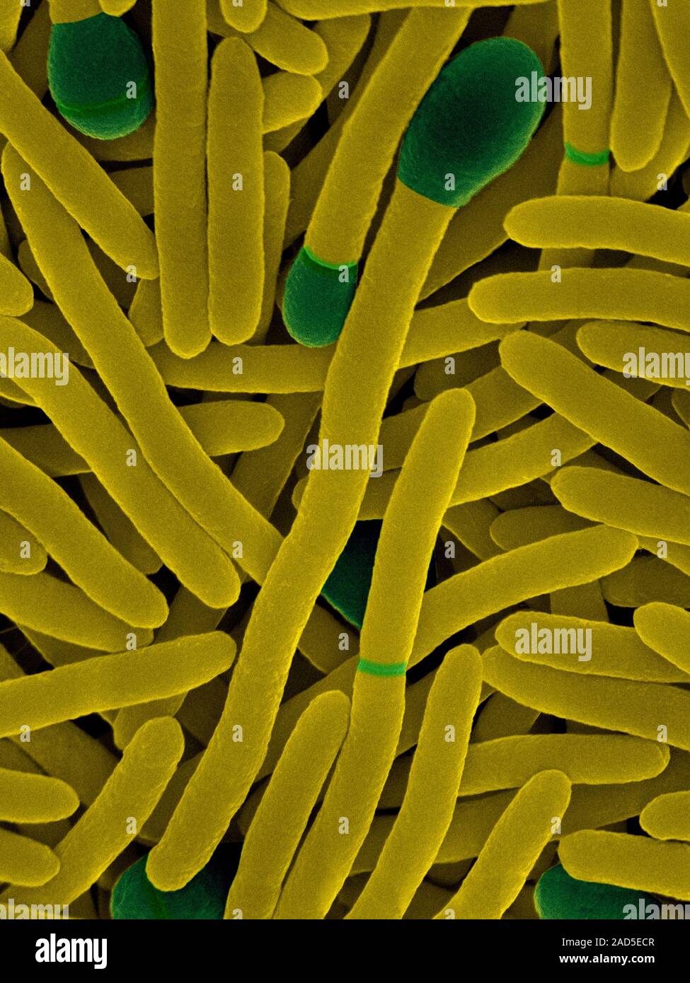 Coloured scanning electron micrograph (SEM) of Clostridium ...