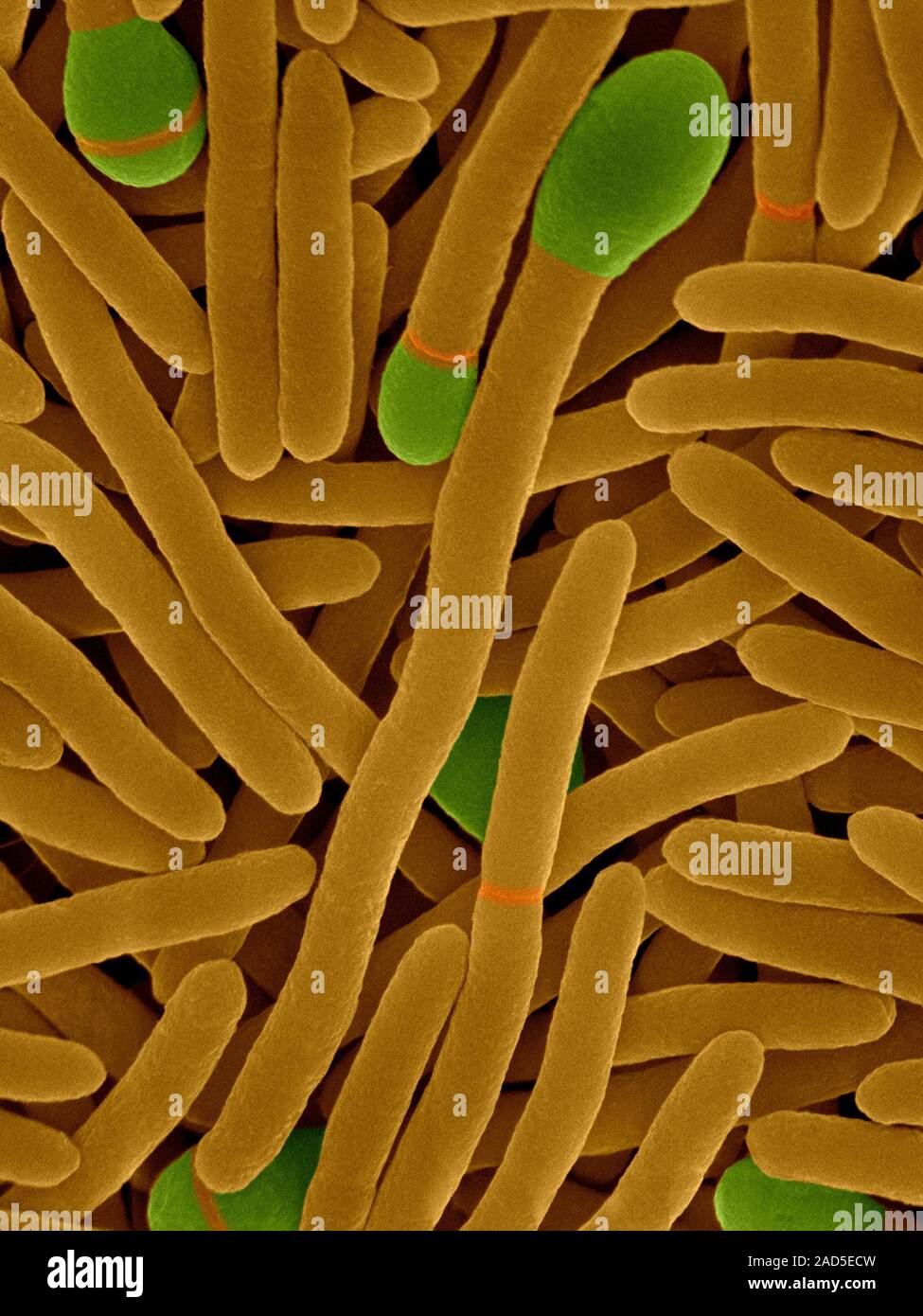 Coloured scanning electron micrograph (SEM) of Clostridium ...