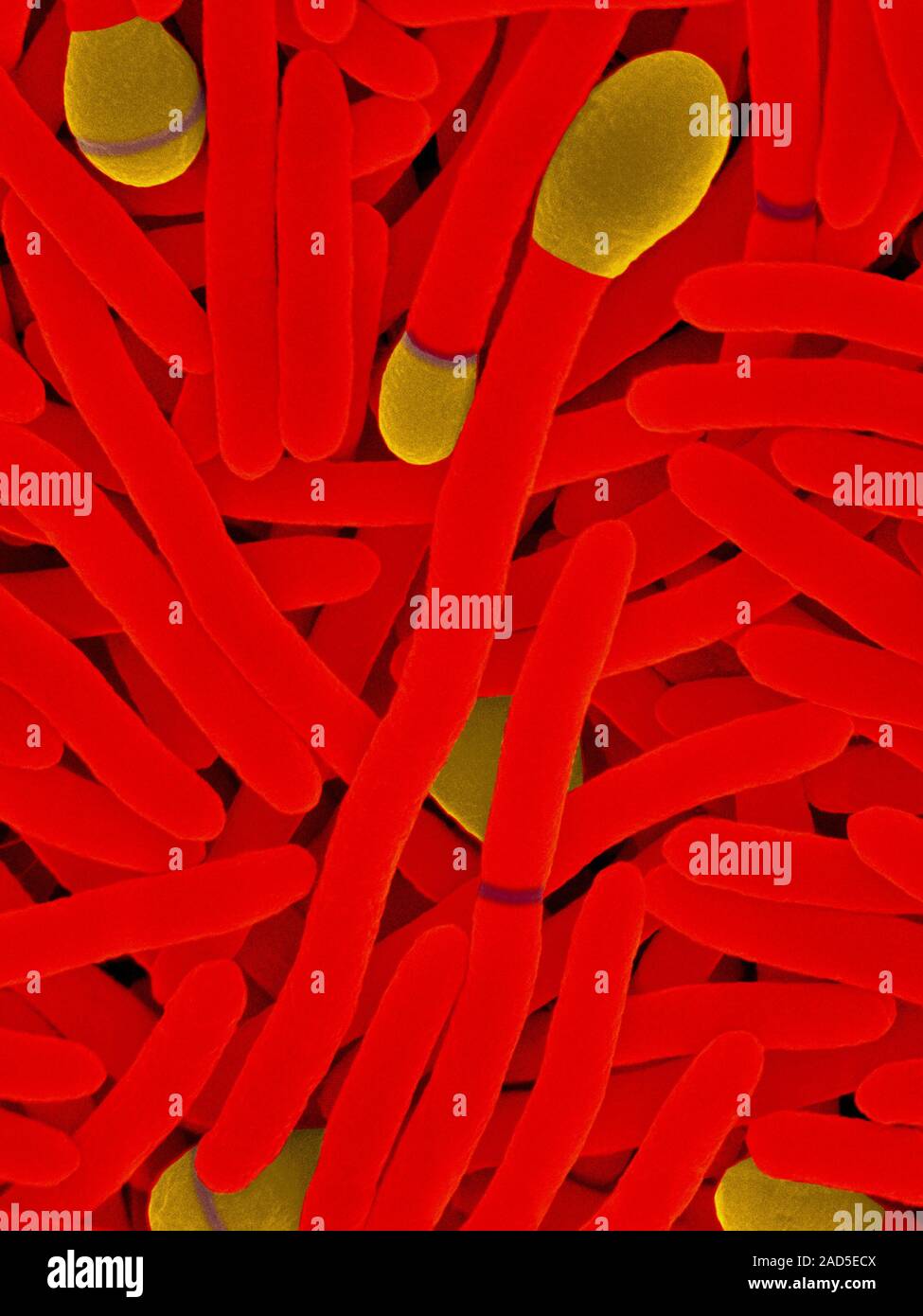 Coloured scanning electron micrograph (SEM) of Clostridium ...