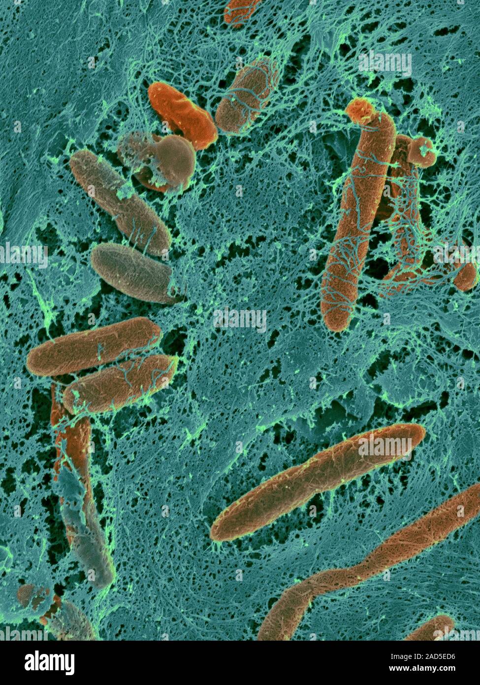 Coloured scanning electron micrograph (SEM) of Shewanella putrefaciens ...
