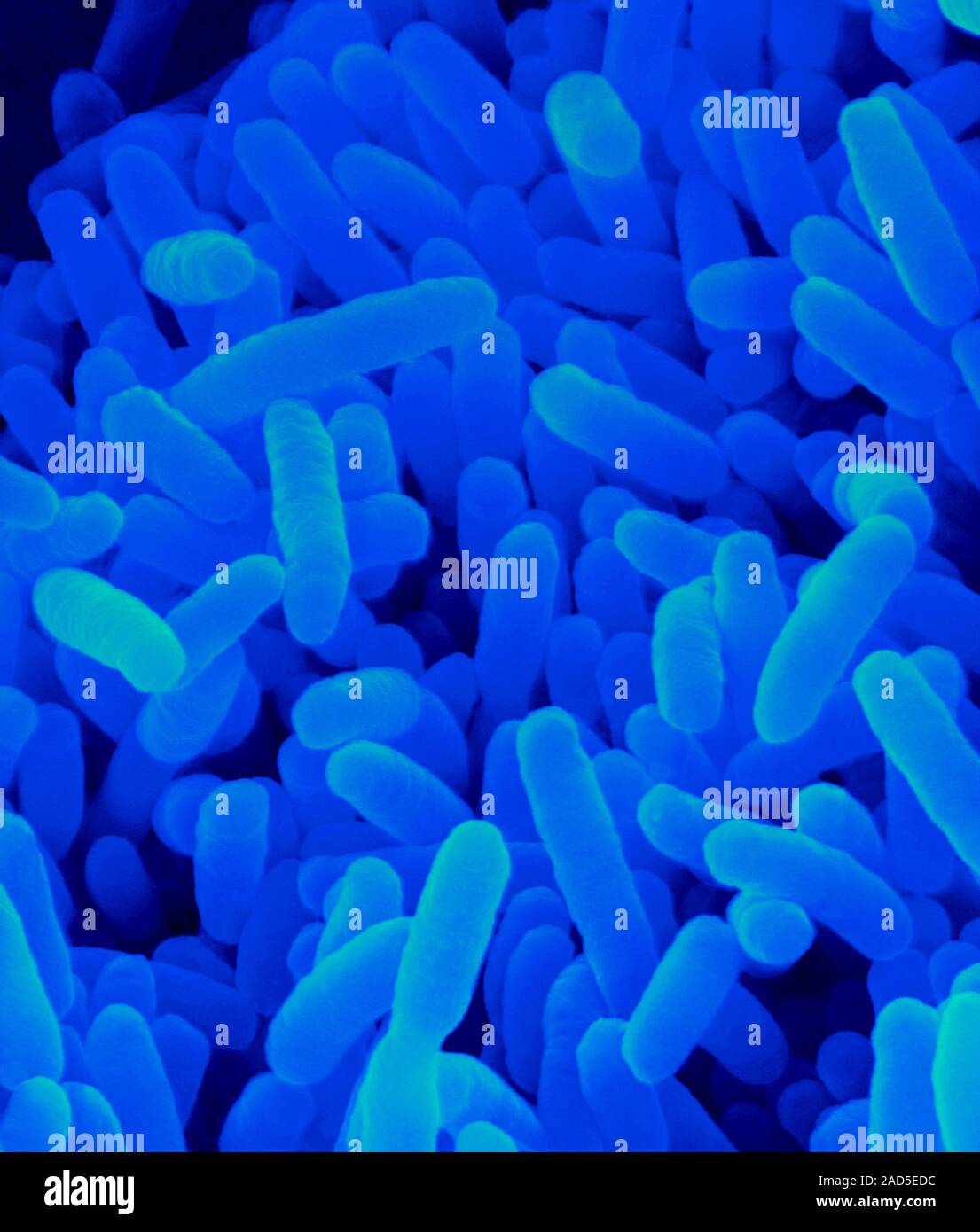 Coloured scanning electron micrograph (SEM) of Bacteroides ...