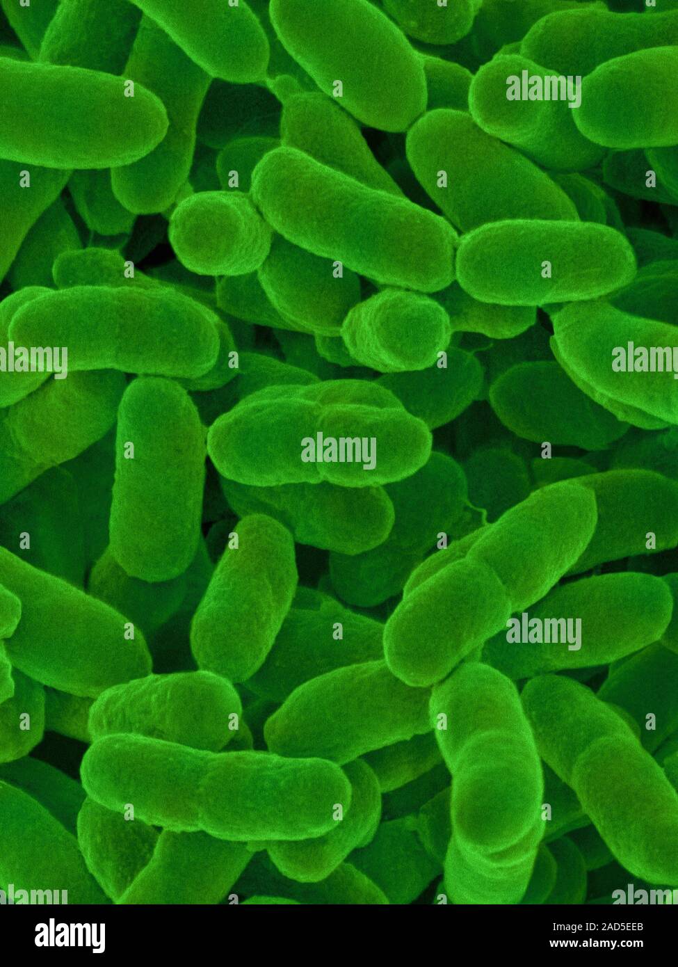 Coloured scanning electron micrograph (SEM) of Sphingomonas ...