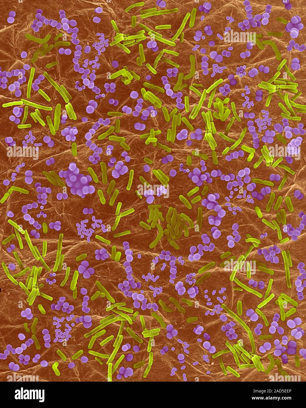 Coloured scanning electron micrograph (SEM) of Photocomposite of ...