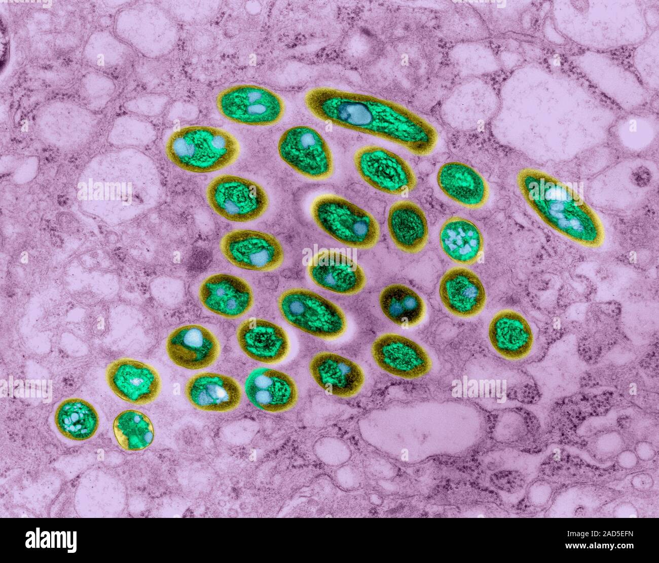Coloured transmission electron micrograph (TEM) of Mycobacterium avium ...