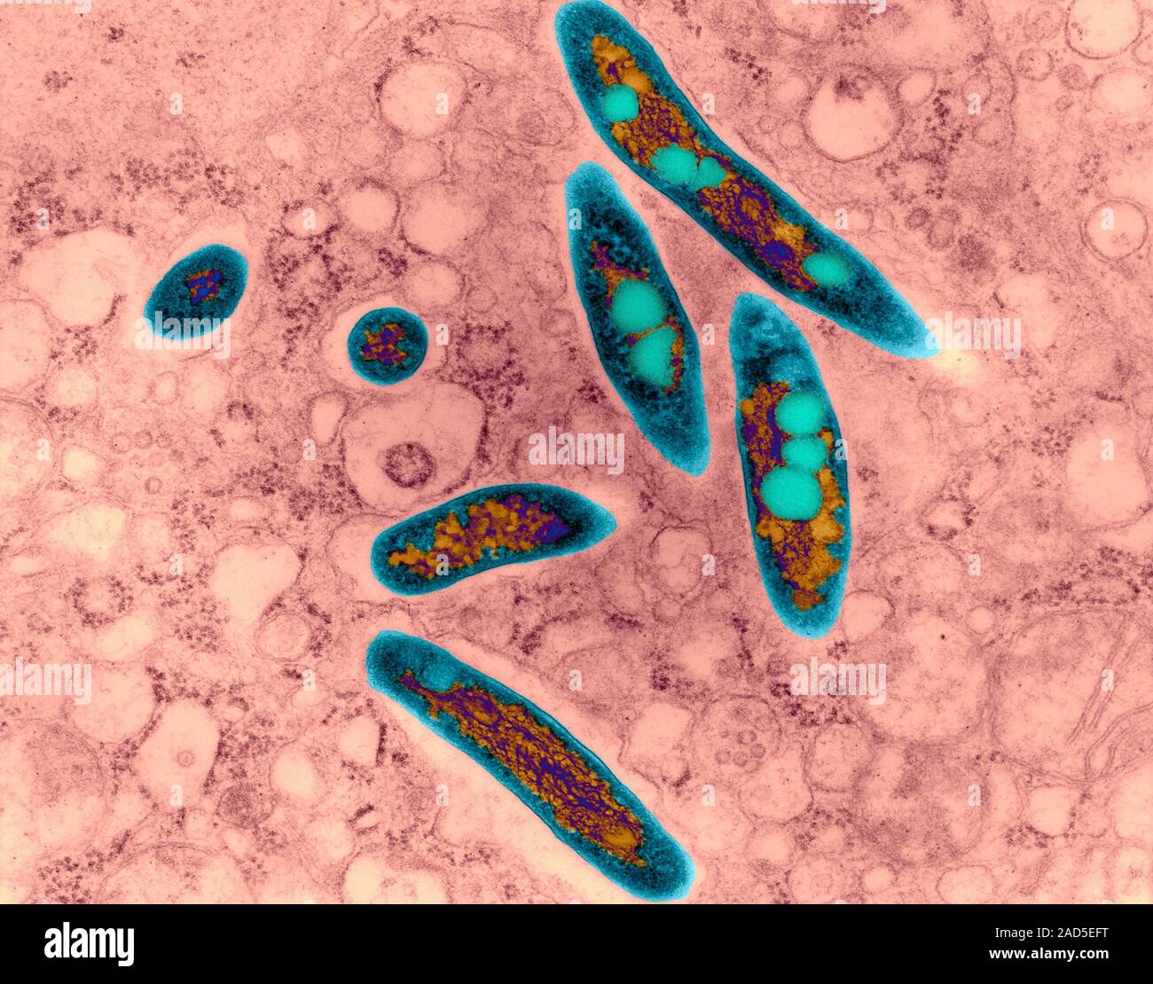 Coloured transmission electron micrograph (TEM) of Mycobacterium avium ...
