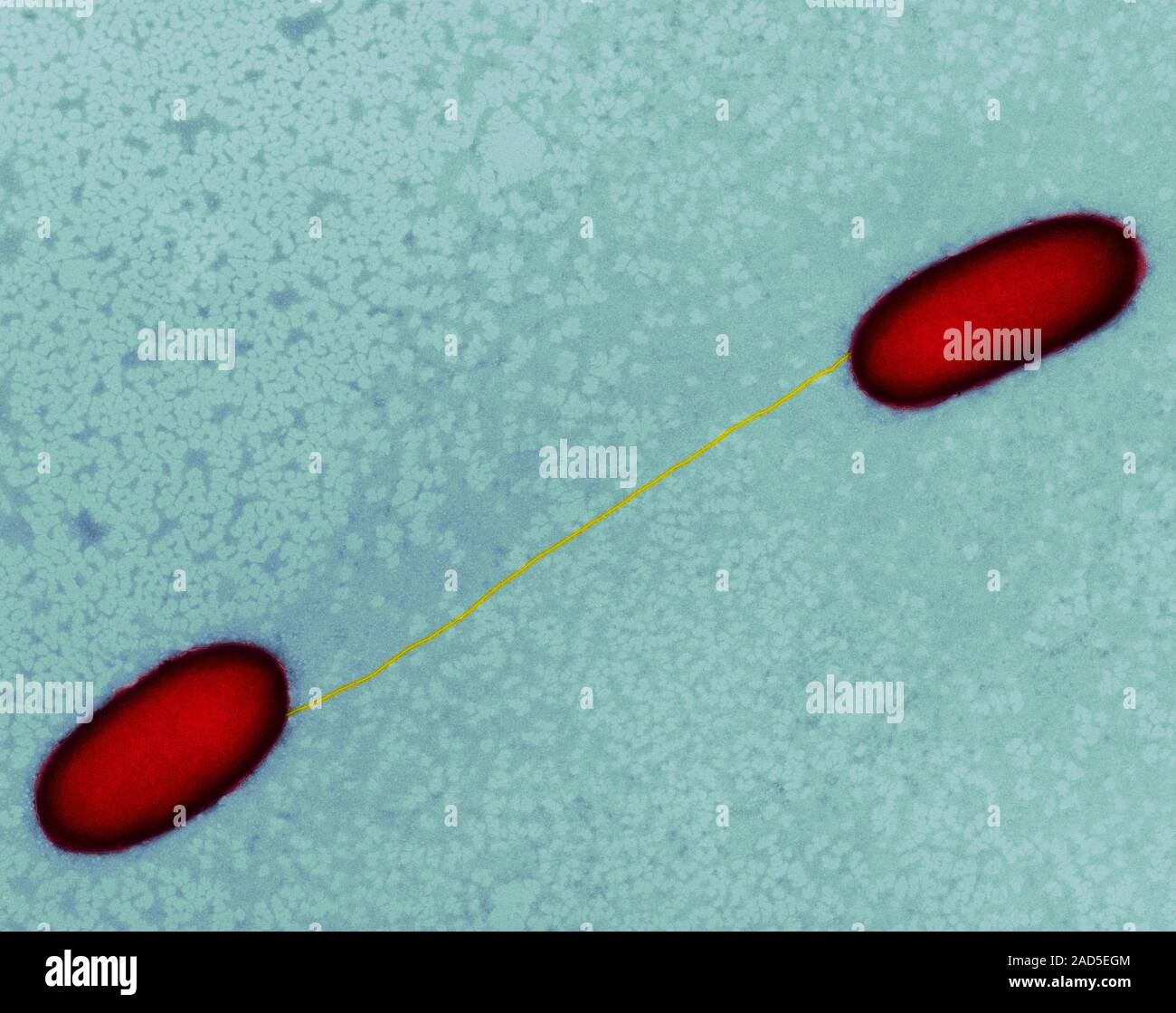 Coloured transmission electron micrograph (TEM) of E. coli strains ...