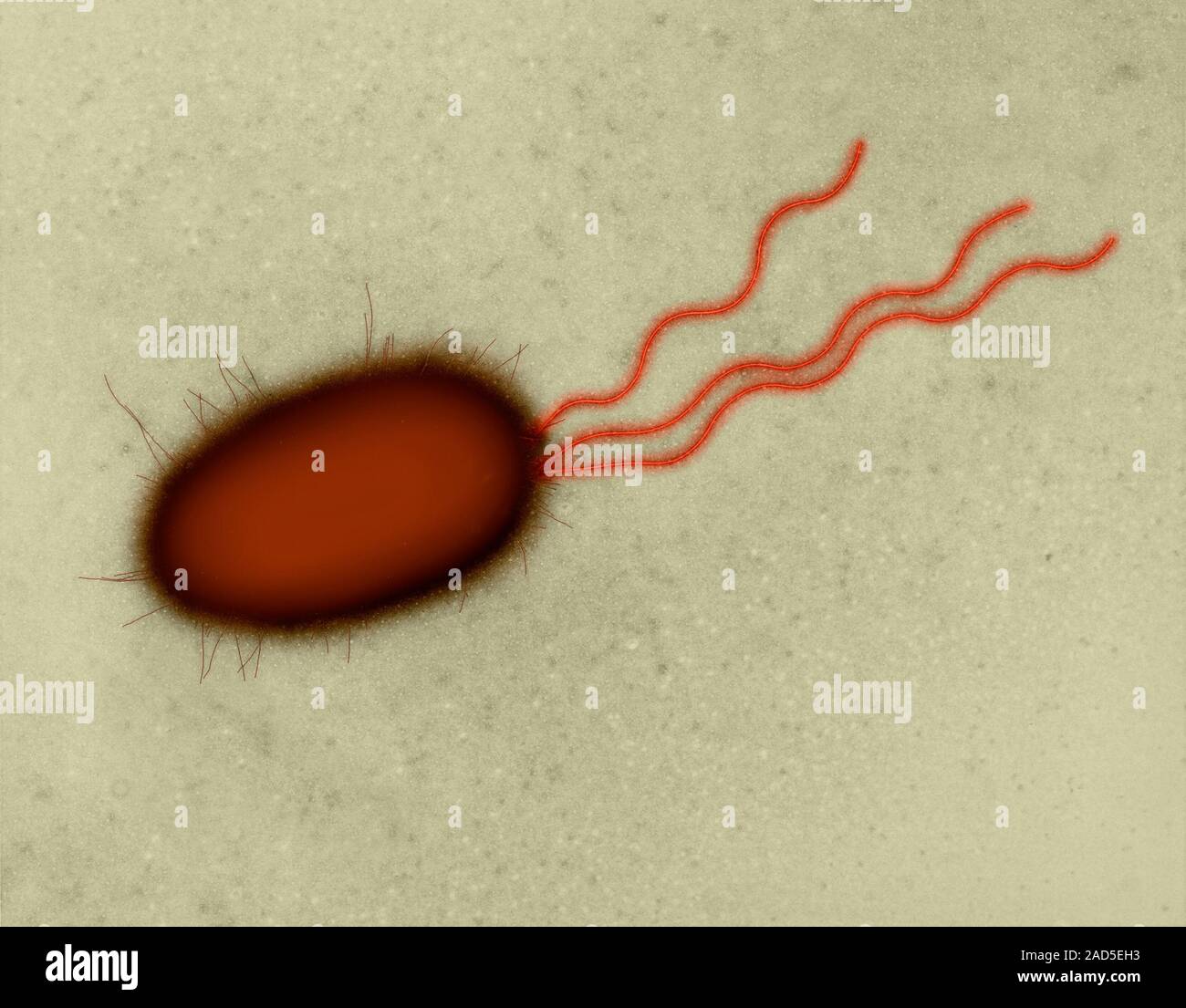 Coloured transmission electron micrograph (TEM) of Escherichia coli is ...