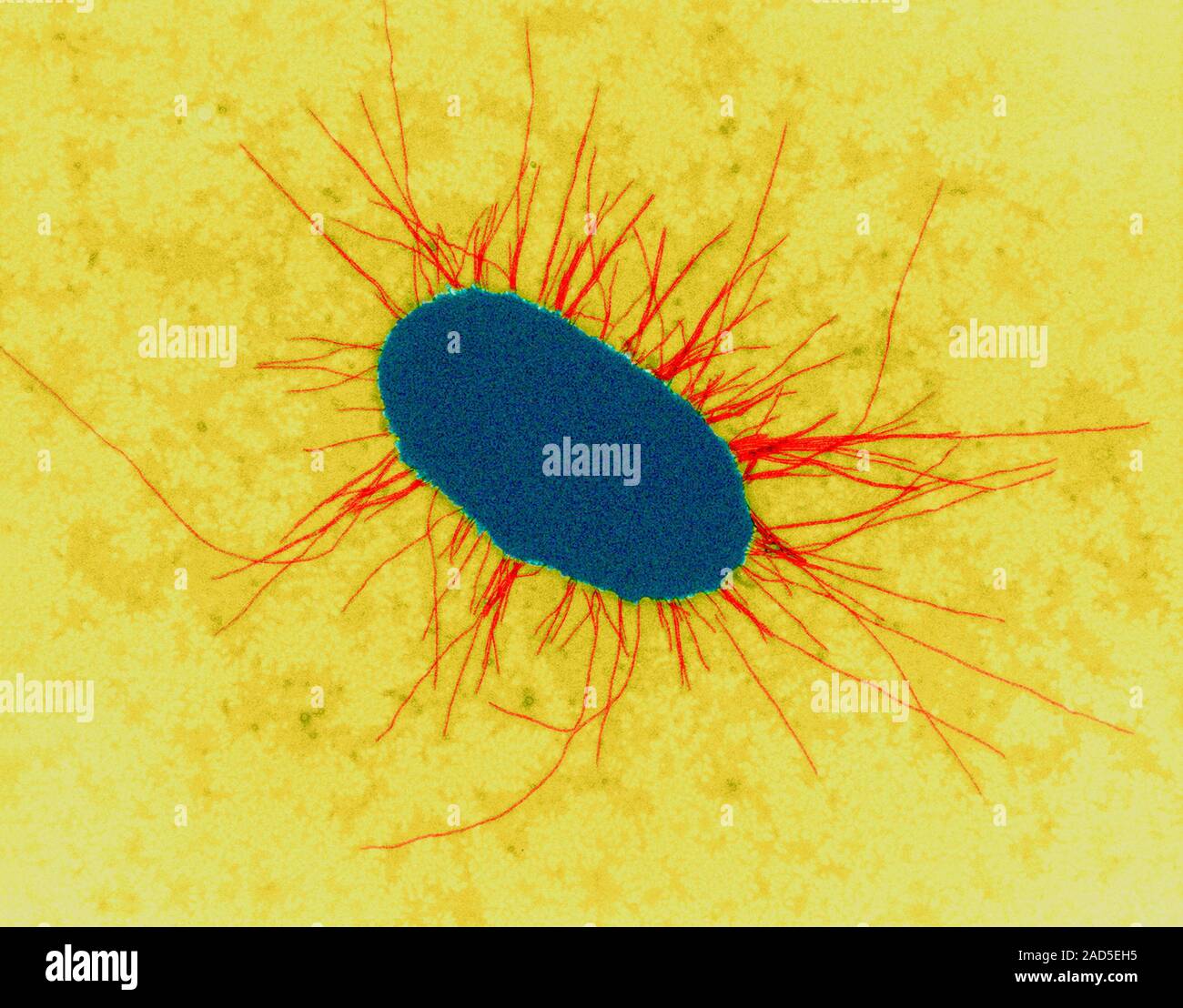Coloured transmission electron micrograph (TEM) of Escherichia coli is ...
