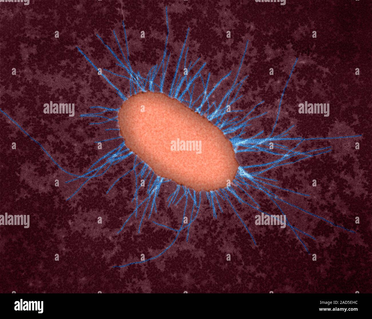 Coloured transmission electron micrograph (TEM) of Escherichia coli is ...