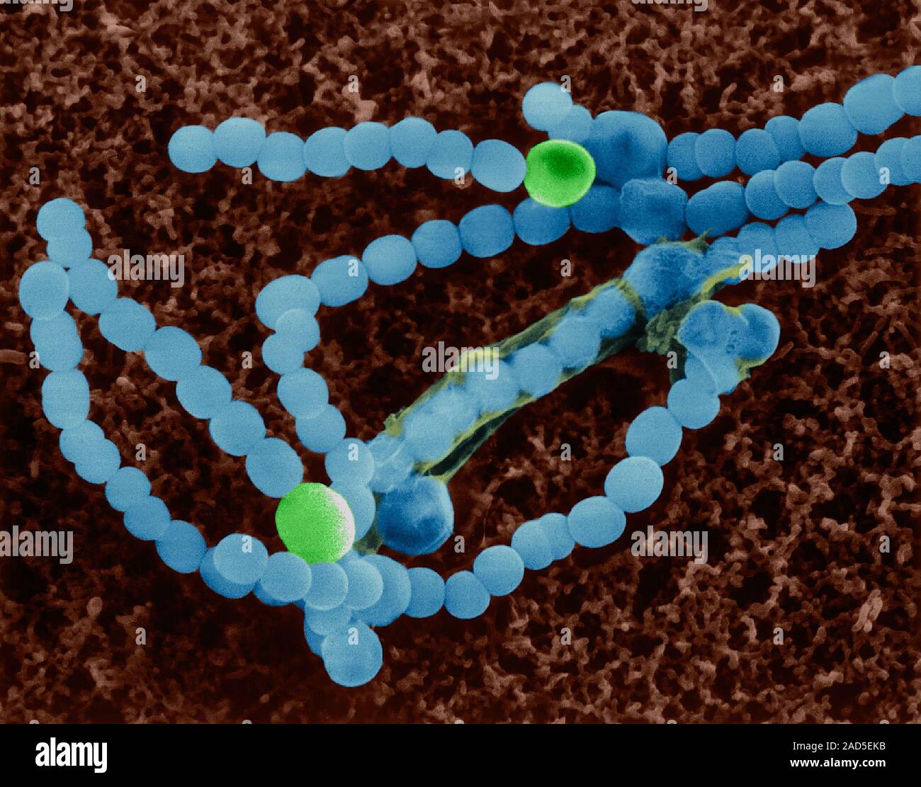 Coloured scanning electron micrograph (SEM) of Anabaena sp., Gram ...