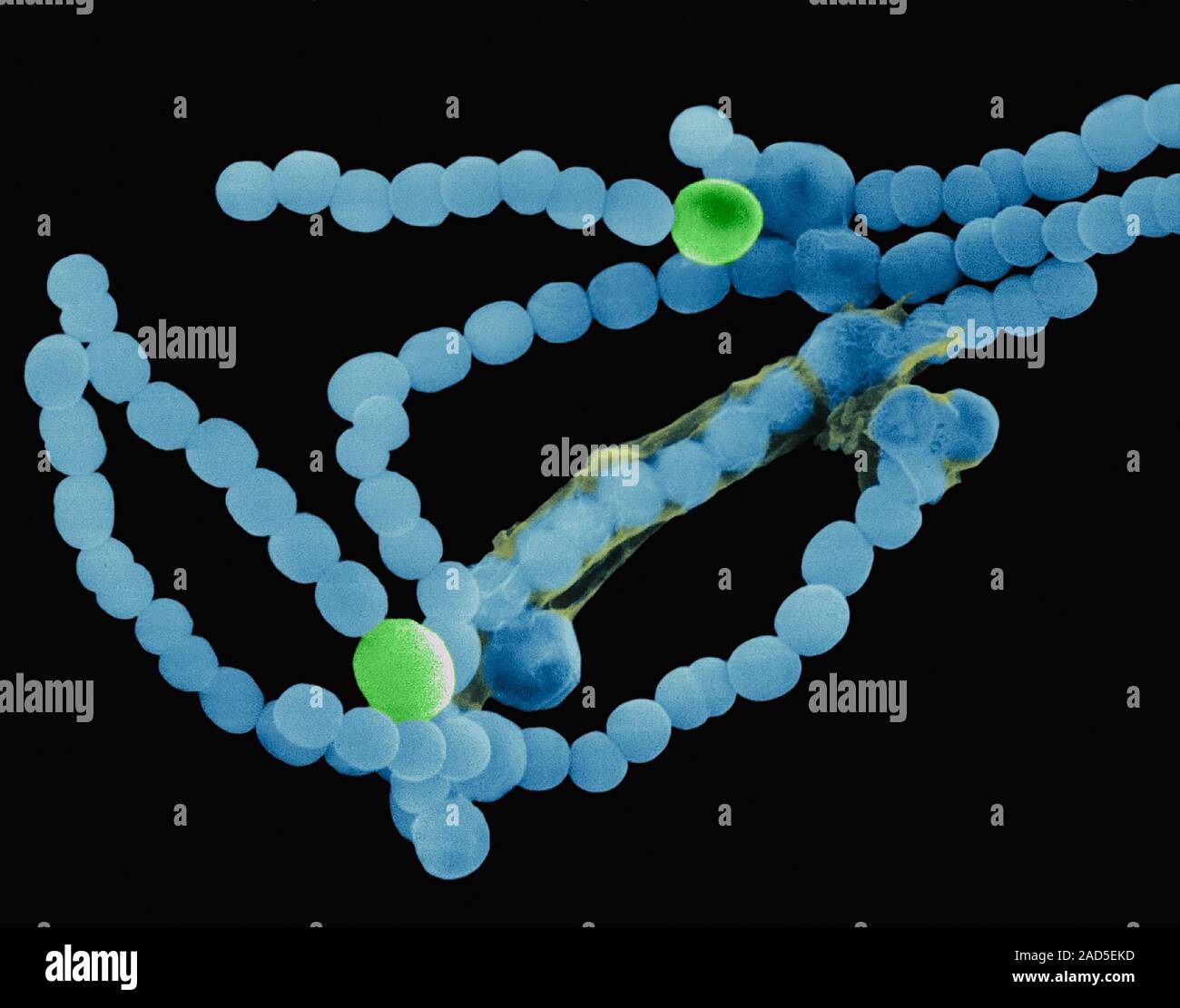 Coloured scanning electron micrograph (SEM) of Anabaena sp., Gram ...