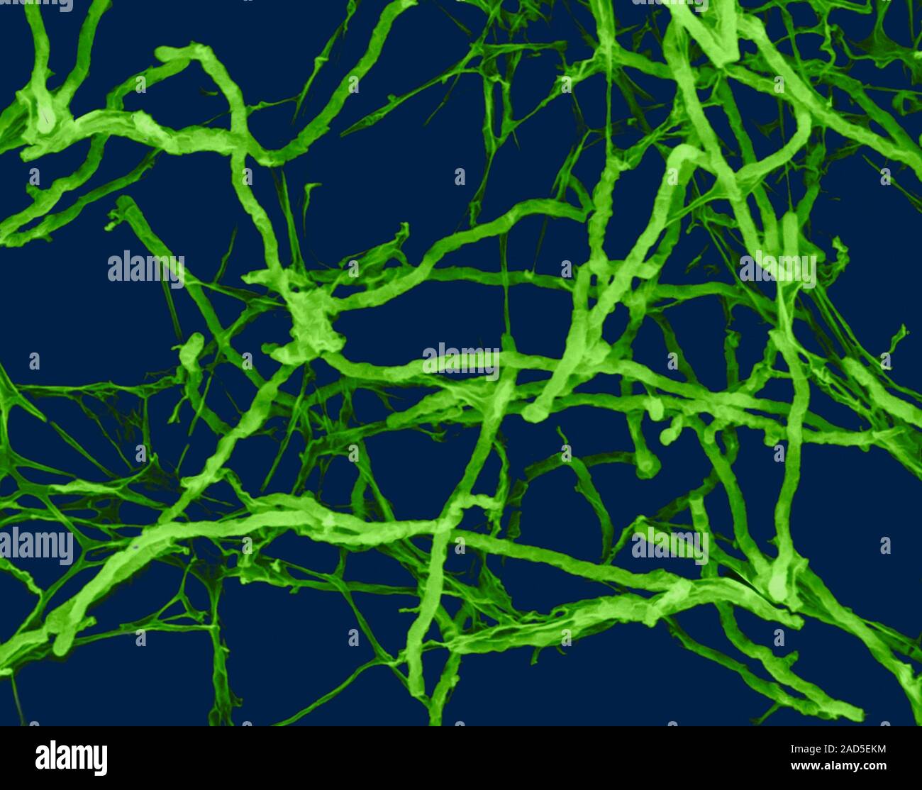 Coloured scanning electron micrograph (SEM) of Streptomyces sp., Gram ...