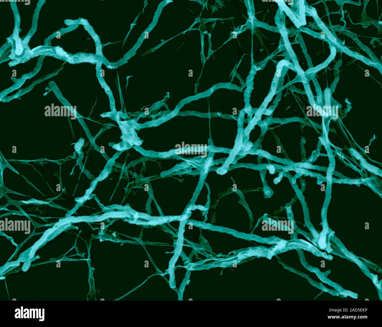 Coloured scanning electron micrograph (SEM) of Streptomyces sp., Gram ...