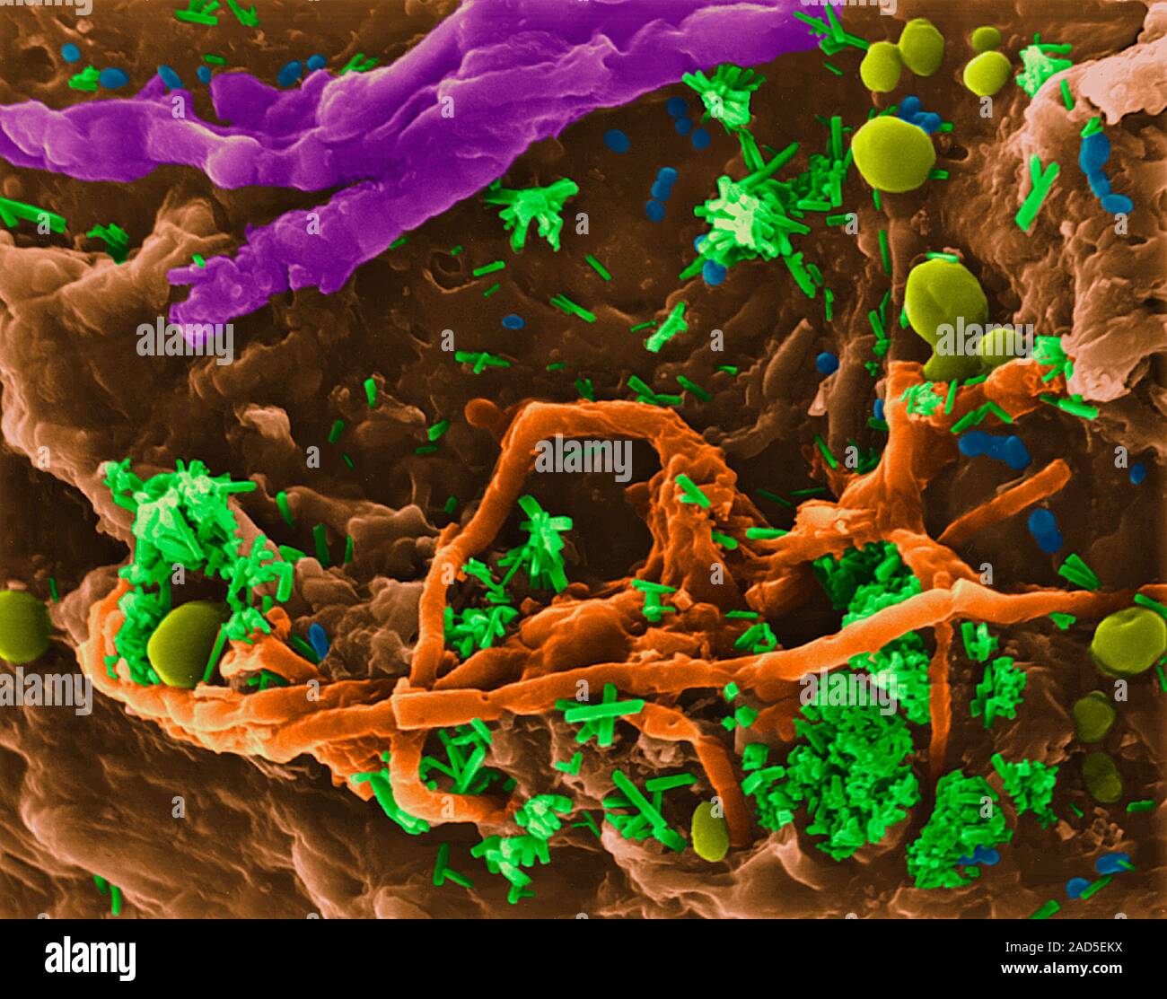 Coloured scanning electron micrograph (SEM) of Kitchen sponge microbes ...