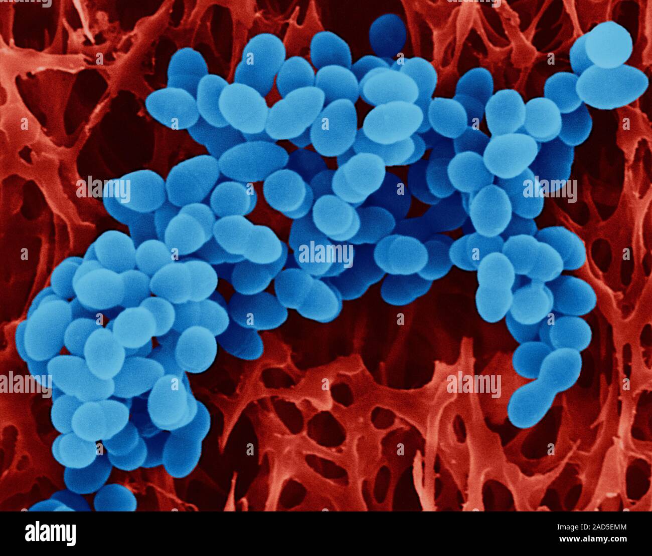 Coloured scanning electron micrograph (SEM) of Staphylococcus aureus ...