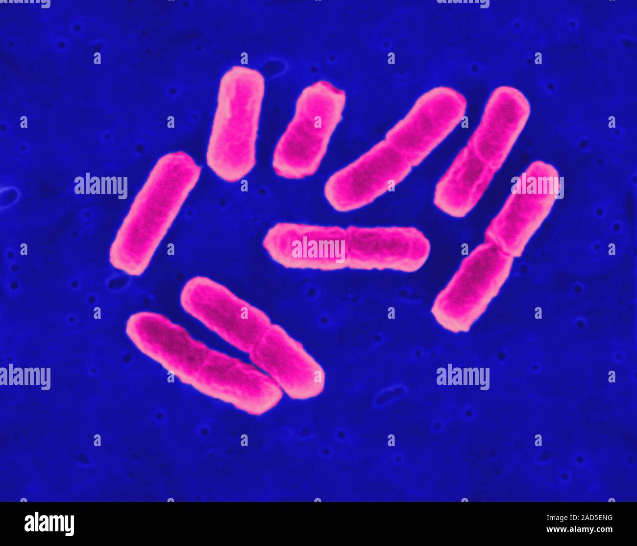 Coloured scanning electron micrograph (SEM) of Escherichia coli is a ...