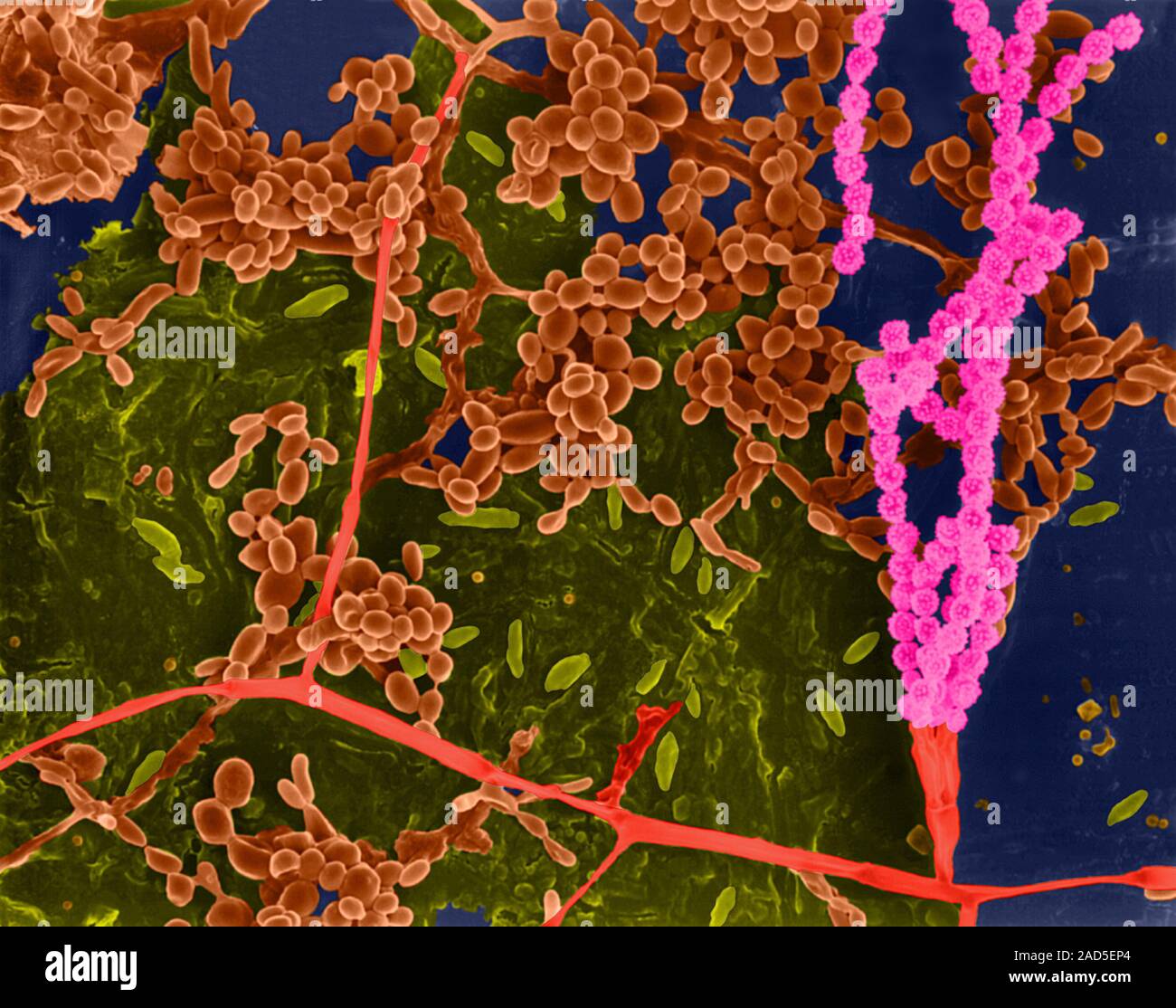 Coloured scanning electron micrograph (SEM) of Contaminated plastic ...