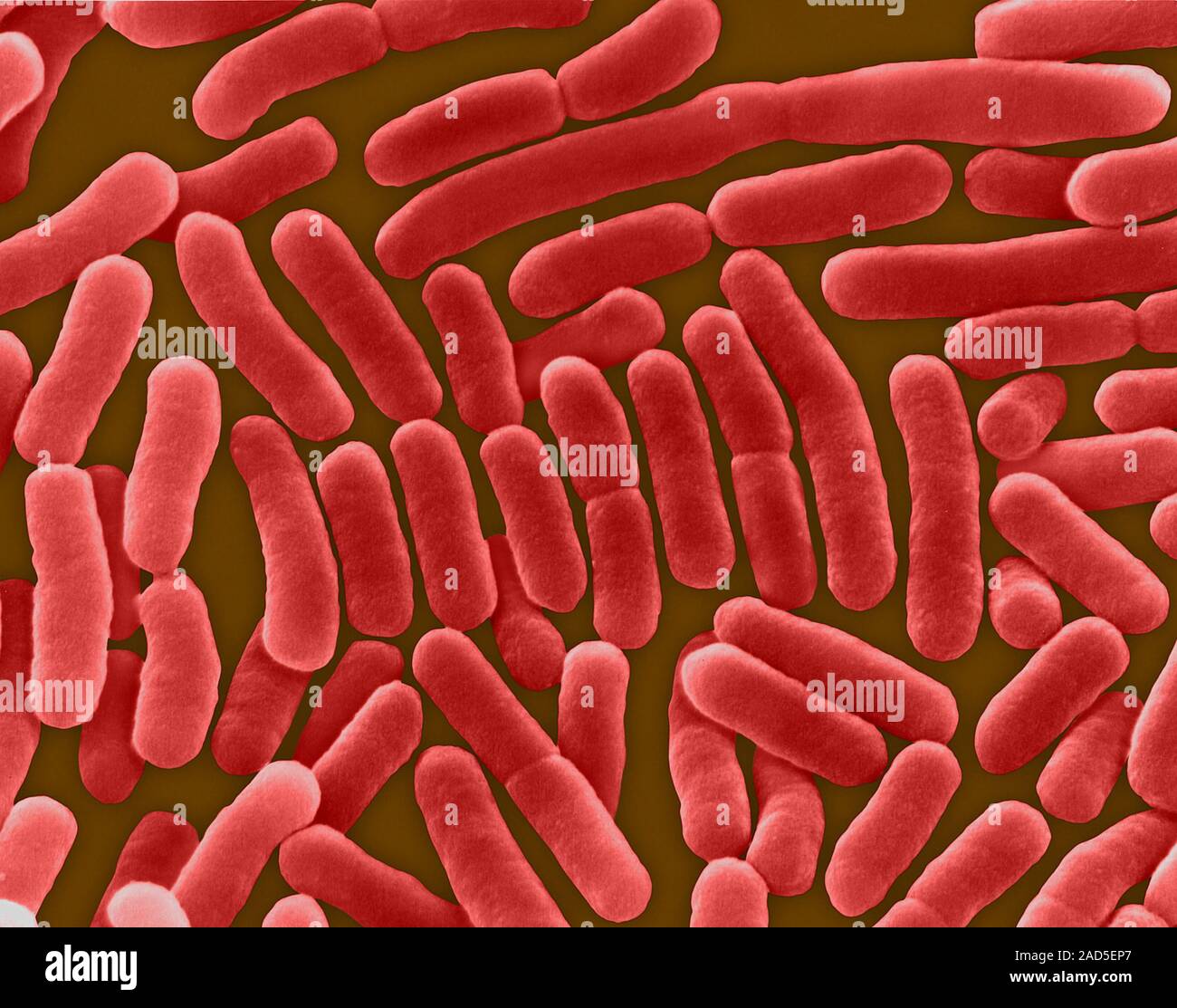 Coloured scanning electron micrograph (SEM) of Salmonella typhi is a ...