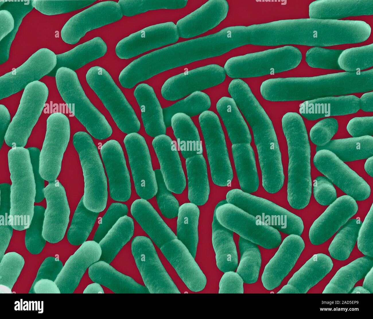 Coloured scanning electron micrograph (SEM) of Salmonella typhi is a ...