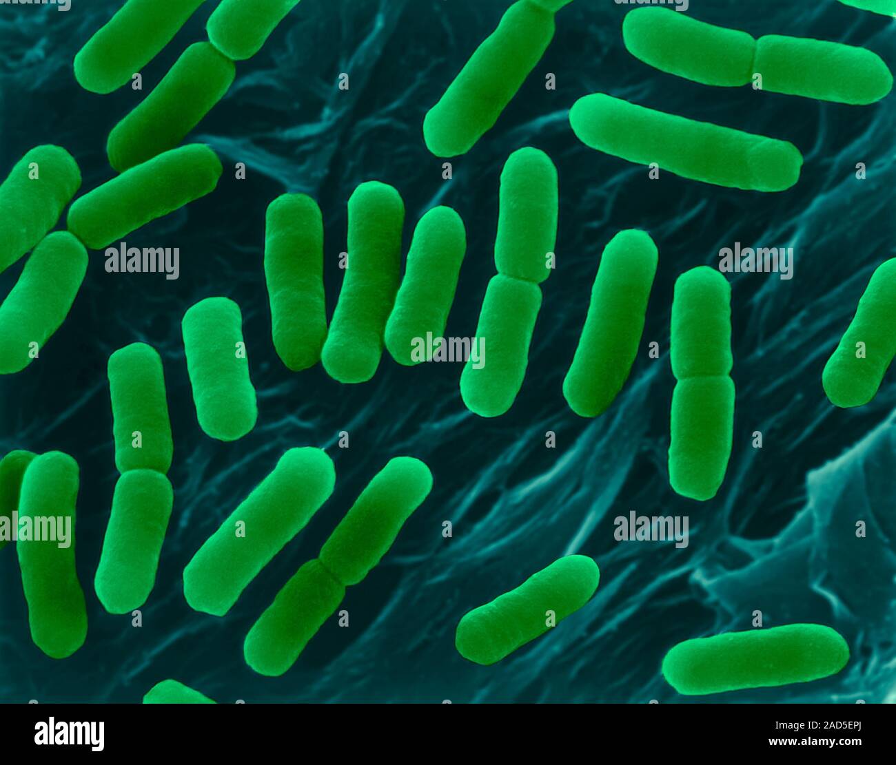 Coloured scanning electron micrograph (SEM) of E. coli (Escherichia ...