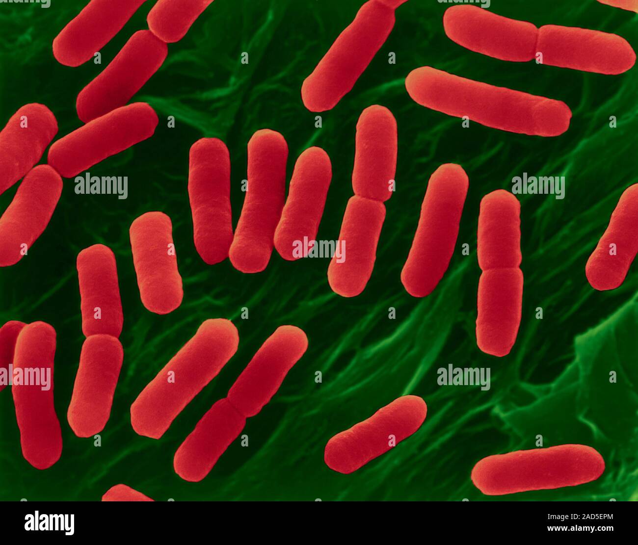 Coloured scanning electron micrograph (SEM) of E. coli (Escherichia ...