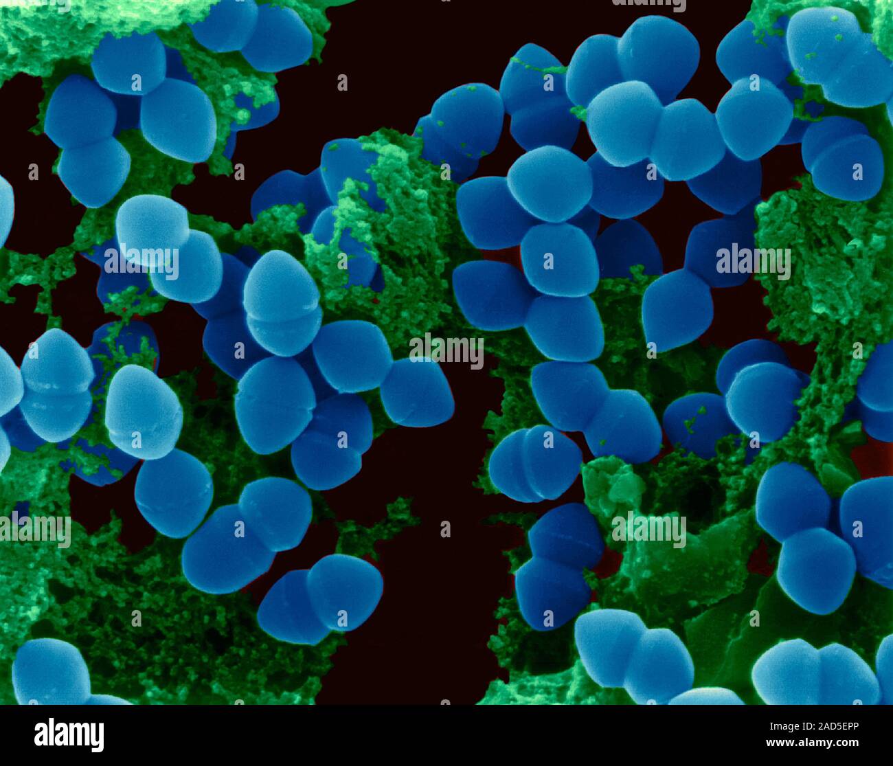 Coloured scanning electron micrograph (SEM) of Enterococcus faecium ...