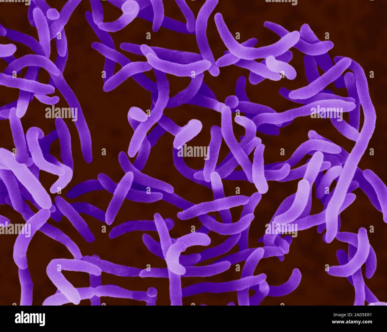 Coloured scanning electron micrograph (SEM) of Vibrio cholerae is a ...