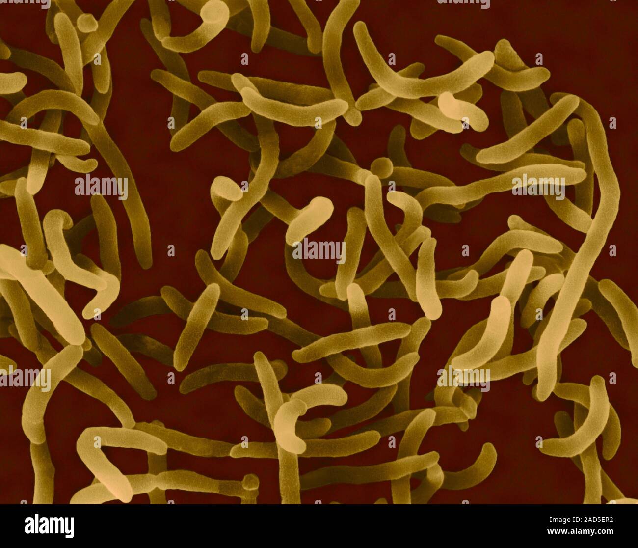 Coloured scanning electron micrograph (SEM) of Vibrio cholerae is a ...