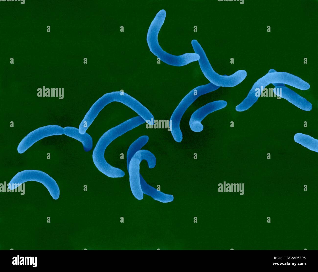 Coloured scanning electron micrograph (SEM) of Vibrio cholerae is a ...