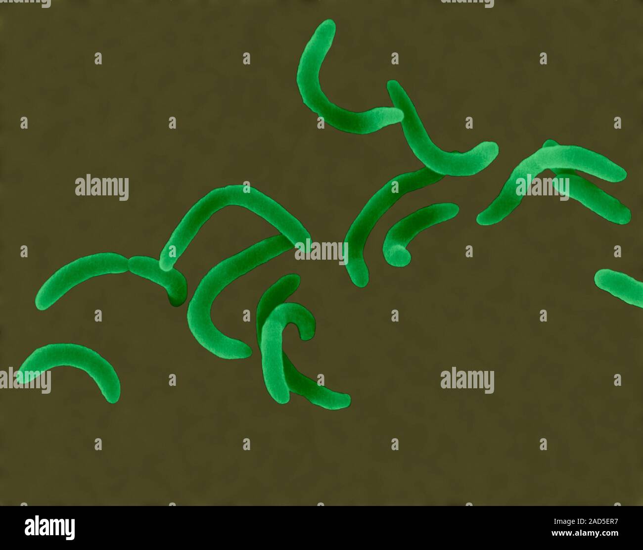 Coloured scanning electron micrograph (SEM) of Vibrio cholerae is a ...