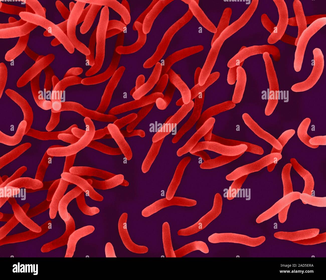 Coloured scanning electron micrograph (SEM) of Vibrio cholerae is a ...
