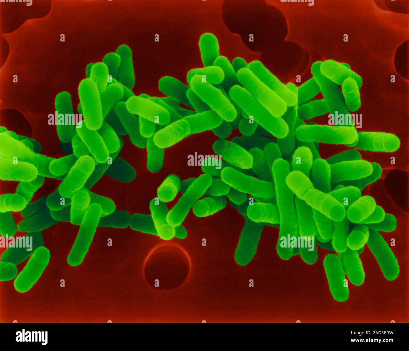 Coloured scanning electron micrograph (SEM) of Legionella pneumophila ...