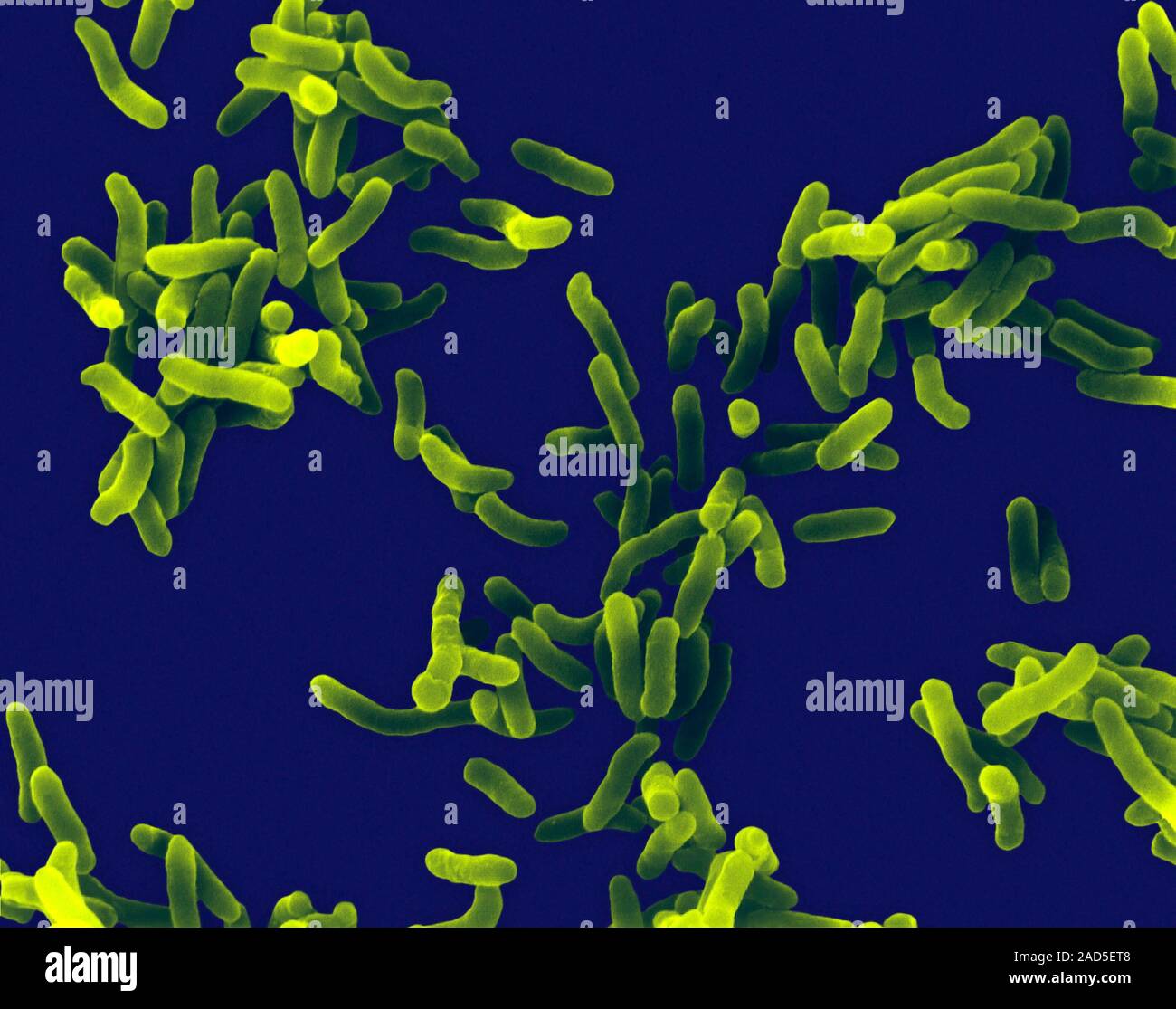 Coloured scanning electron micrograph (SEM) of Aggregatibacter ...