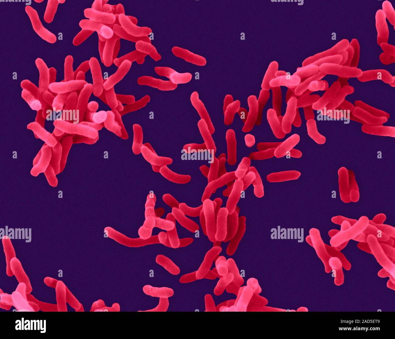 Coloured scanning electron micrograph (SEM) of Aggregatibacter ...