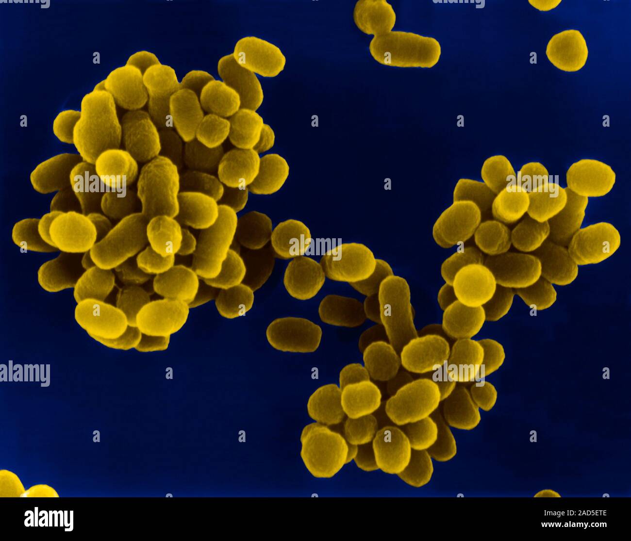 Coloured scanning electron micrograph (SEM) of Brucella abortus, Gram ...
