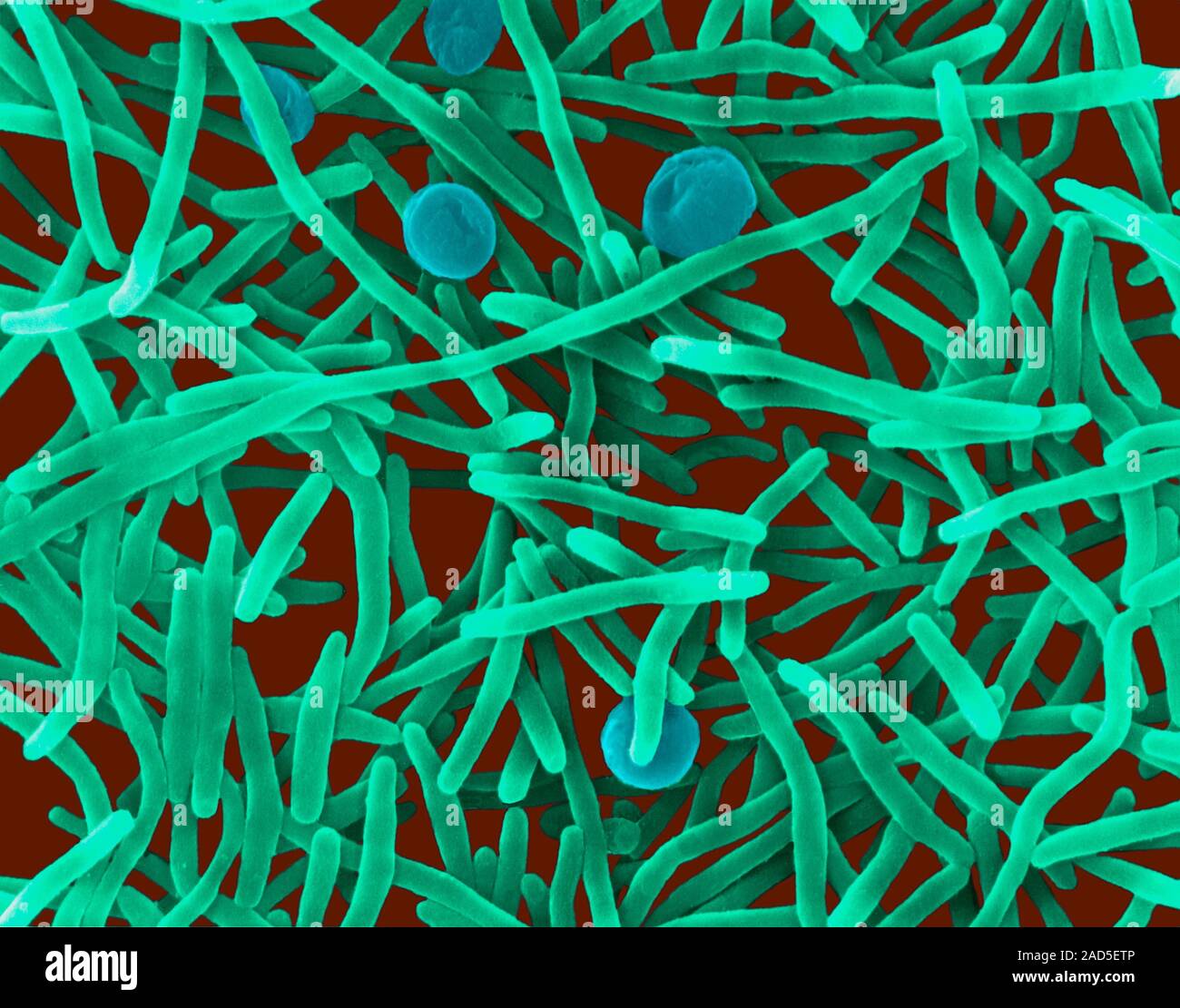 Coloured scanning electron micrograph (SEM) of Capnocytophaga ochracea ...