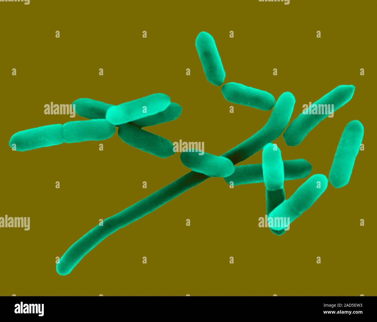 Coloured scanning electron micrograph (SEM) of Listeria monocytogenes ...