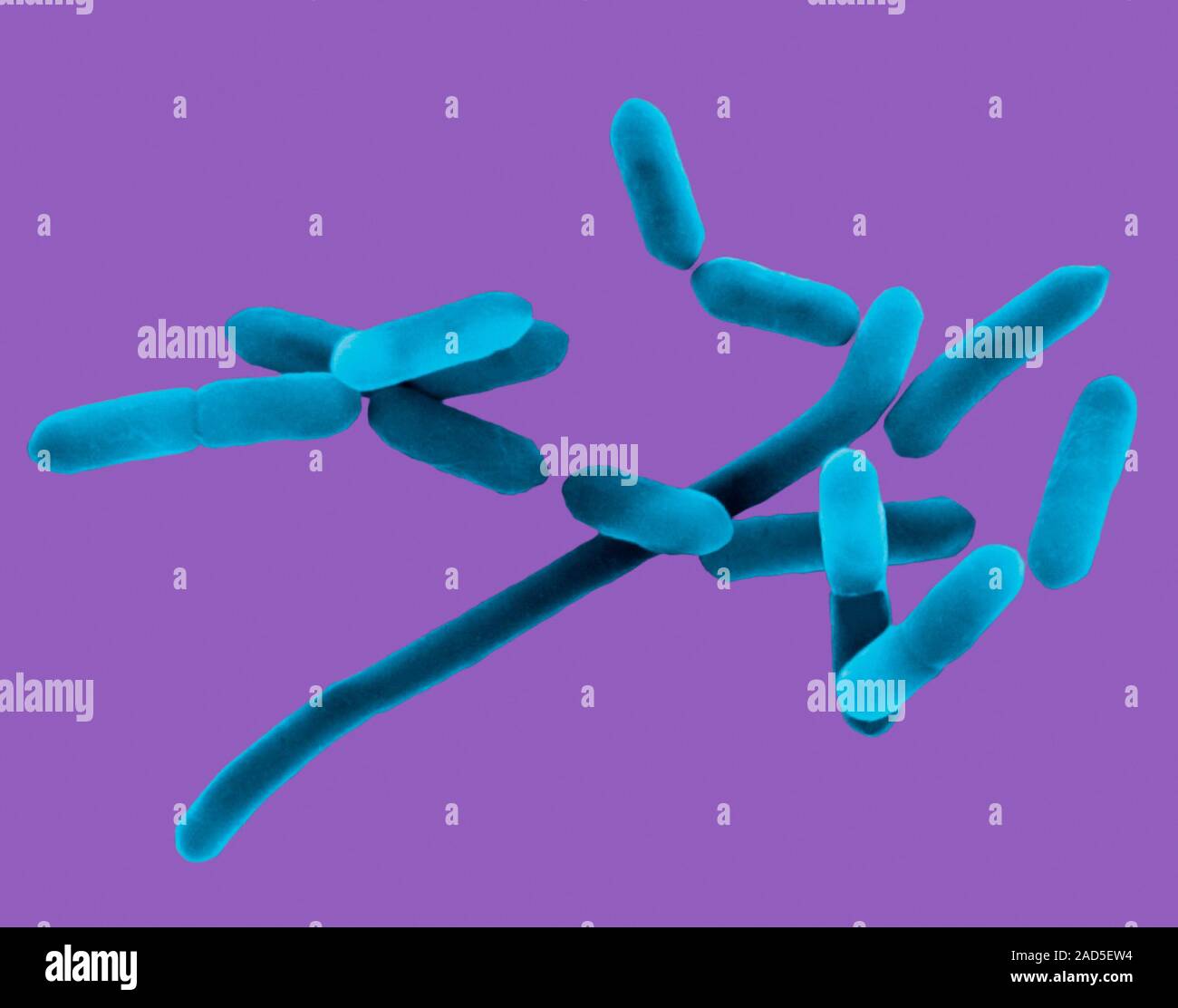 Coloured scanning electron micrograph (SEM) of Listeria monocytogenes ...