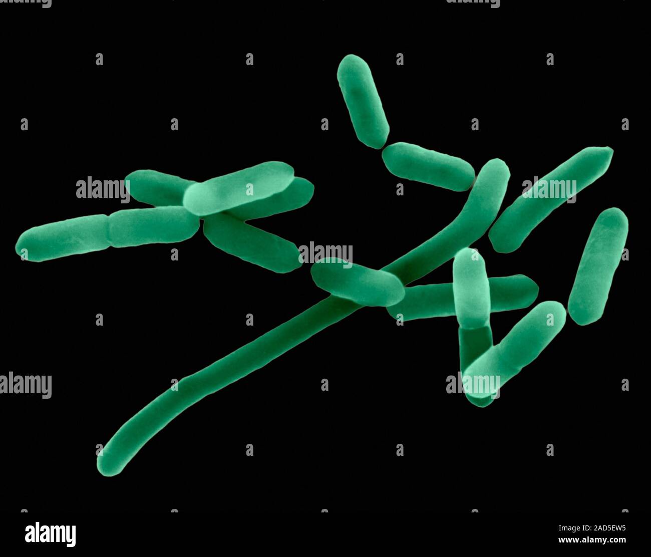 Coloured scanning electron micrograph (SEM) of Listeria monocytogenes ...