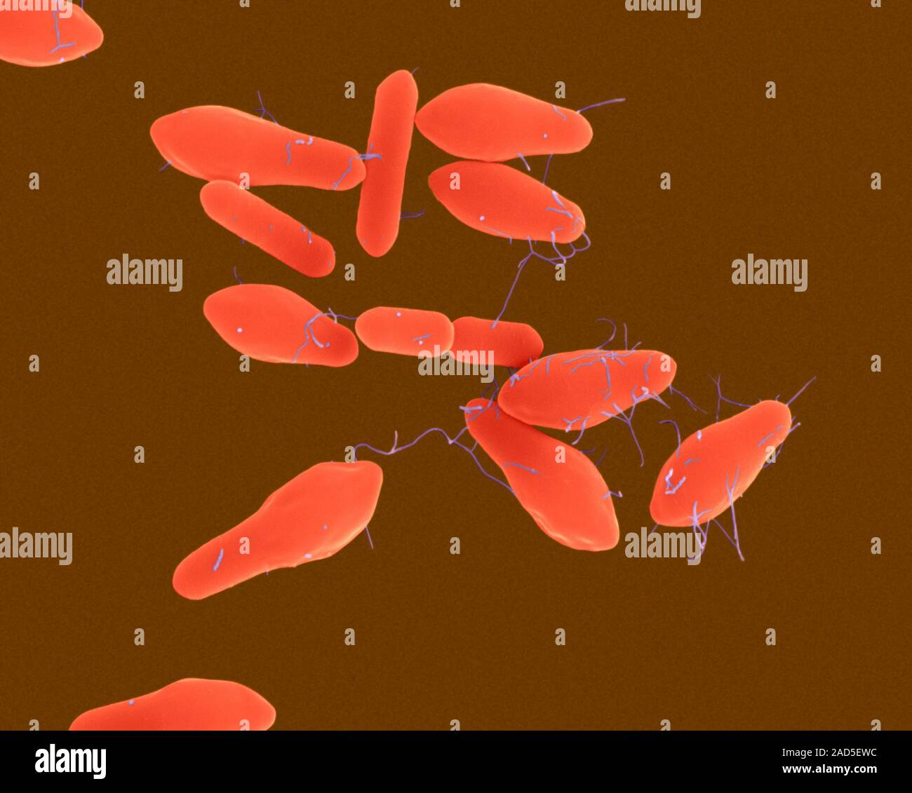 Coloured scanning electron micrograph (SEM) of Clostridium botulinum ...