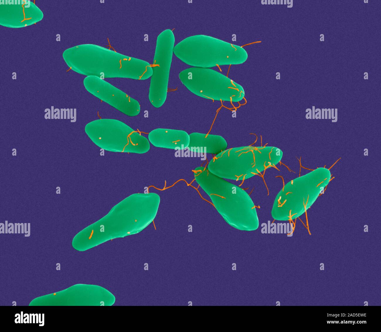 Coloured scanning electron micrograph (SEM) of Clostridium botulinum ...