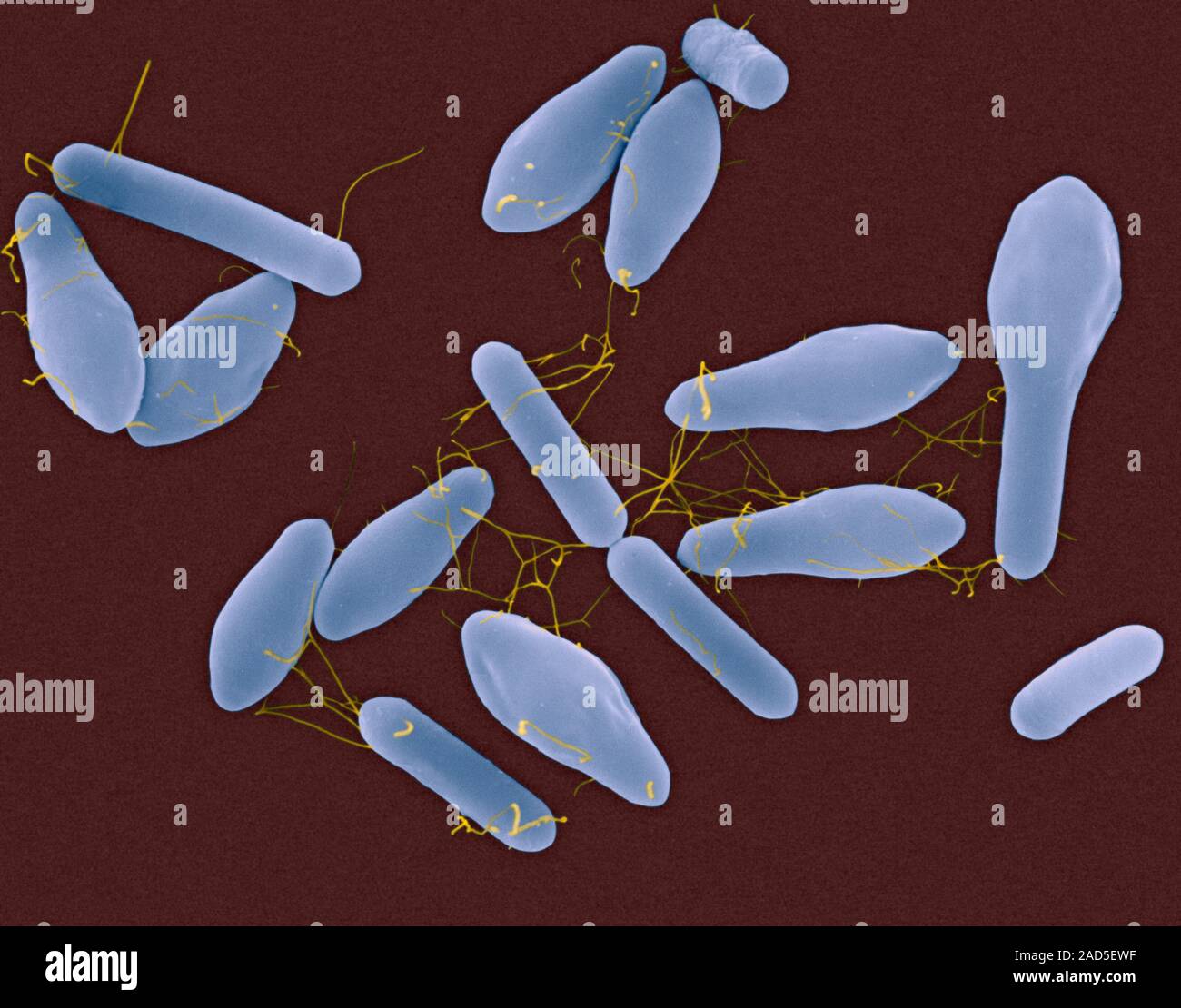 Coloured scanning electron micrograph (SEM) of Clostridium botulinum ...