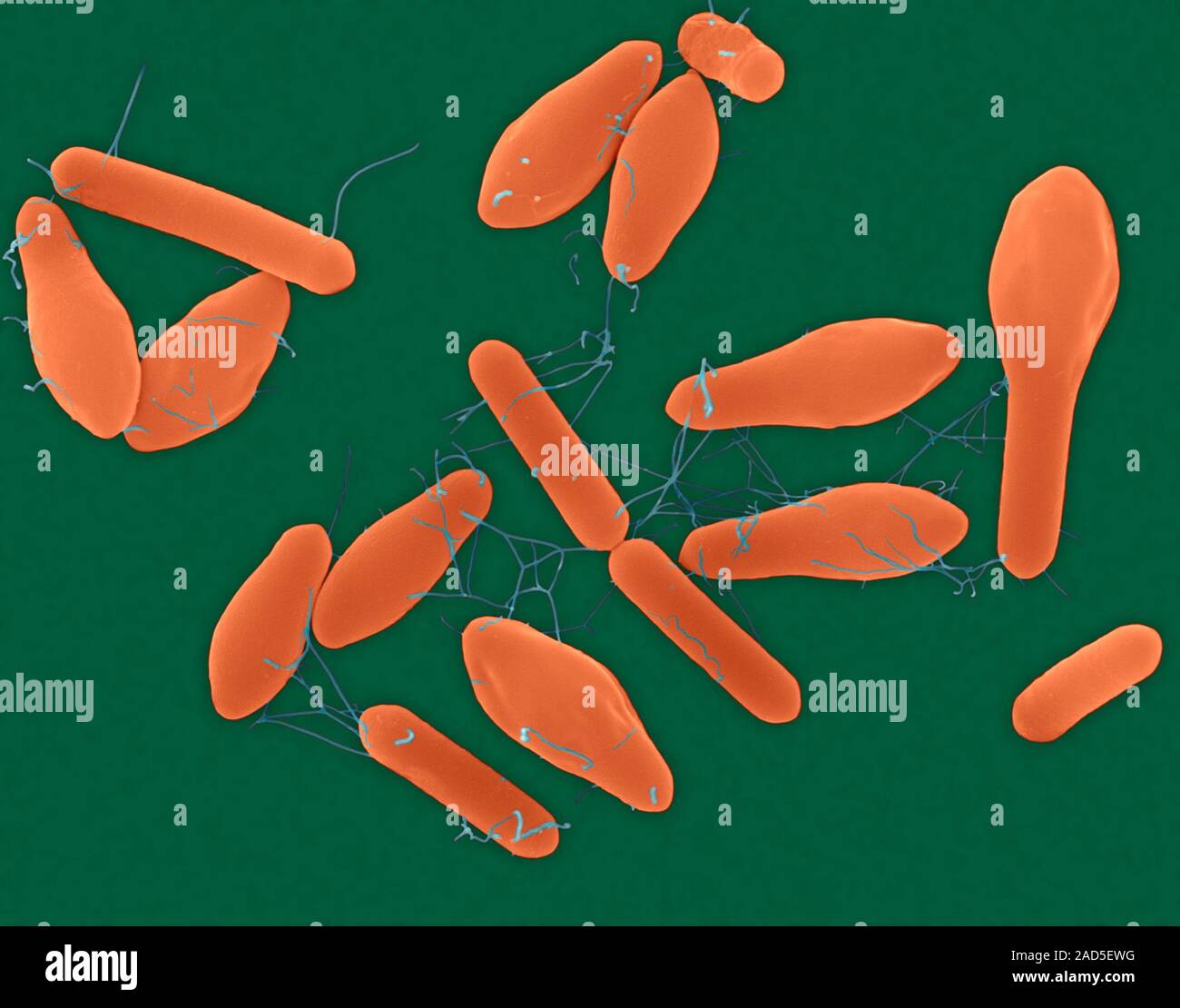 Coloured scanning electron micrograph (SEM) of Clostridium botulinum ...