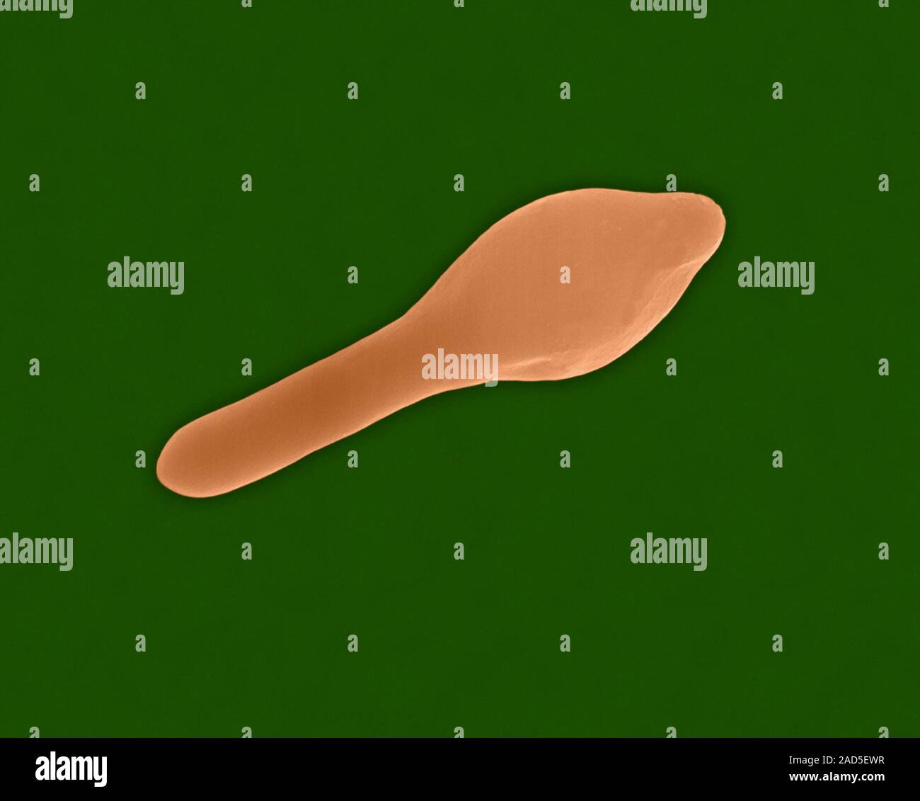 Coloured scanning electron micrograph (SEM) of Clostridium botulinum ...
