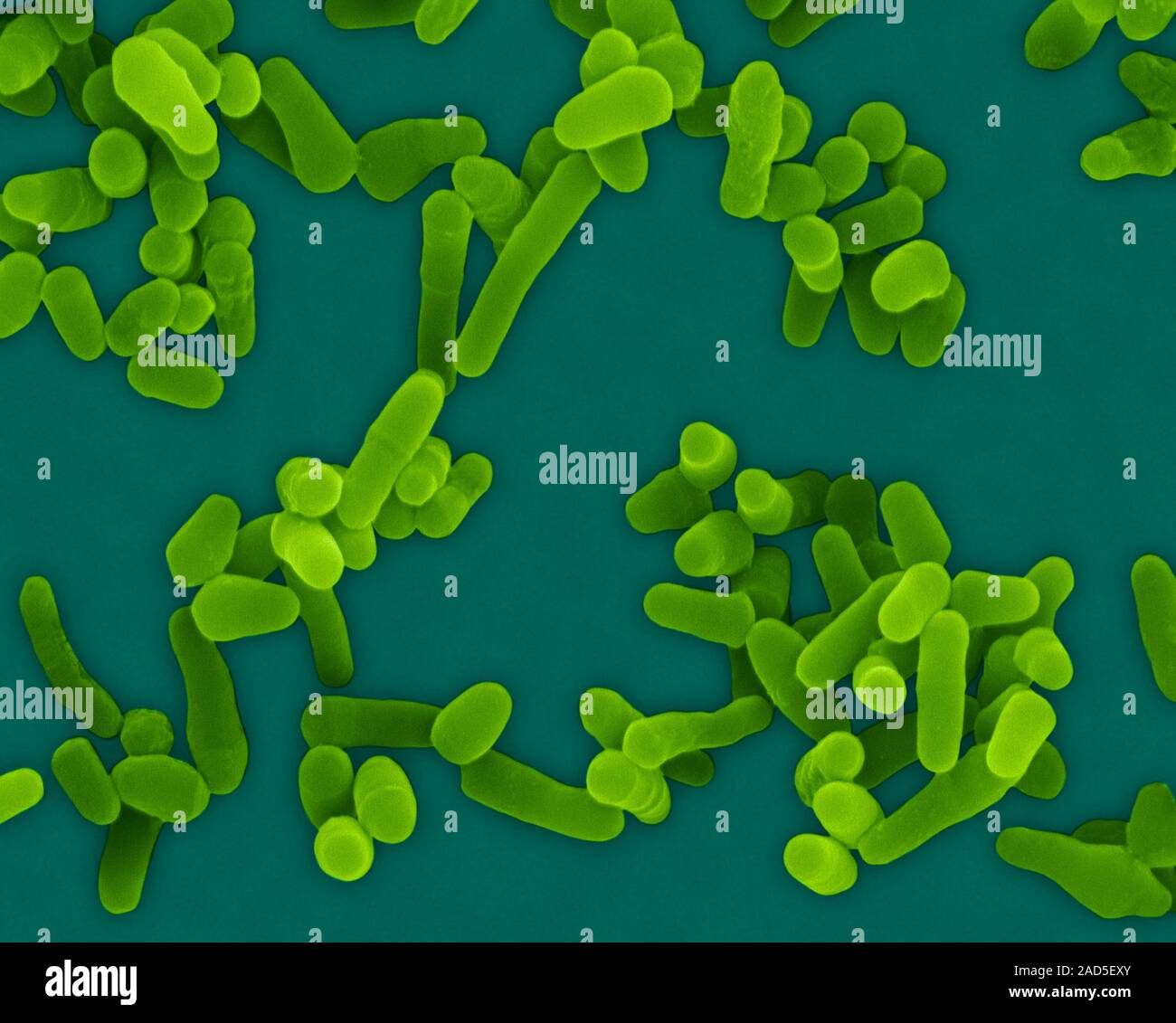 Coloured scanning electron micrograph (SEM) of Mycobacterium avium, rod ...
