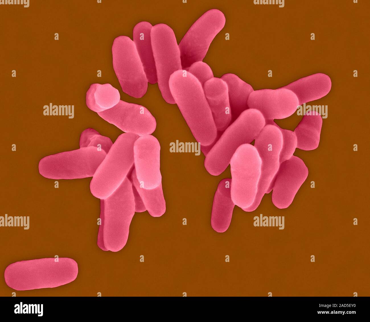 Coloured scanning electron micrograph (SEM) of Mycobacterium tuberculosis is a primary causative ...