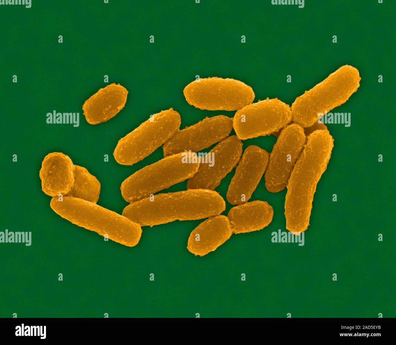 Coloured scanning electron micrograph (SEM) of Yersinia pestis, Gram ...