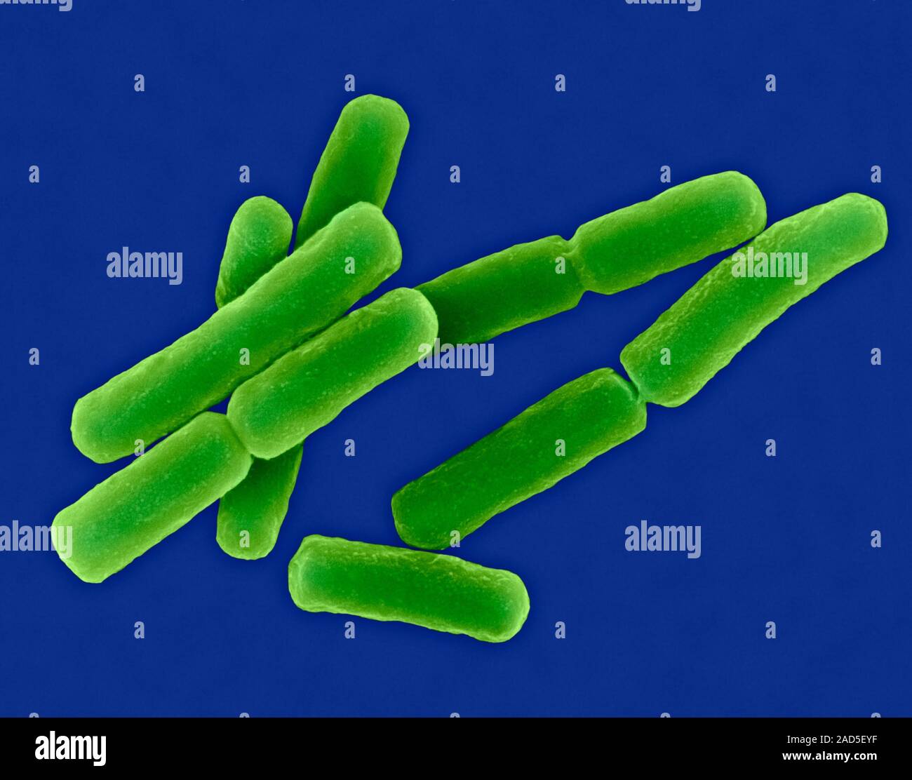 Coloured scanning electron micrograph (SEM) of Bacillus anthracis ...
