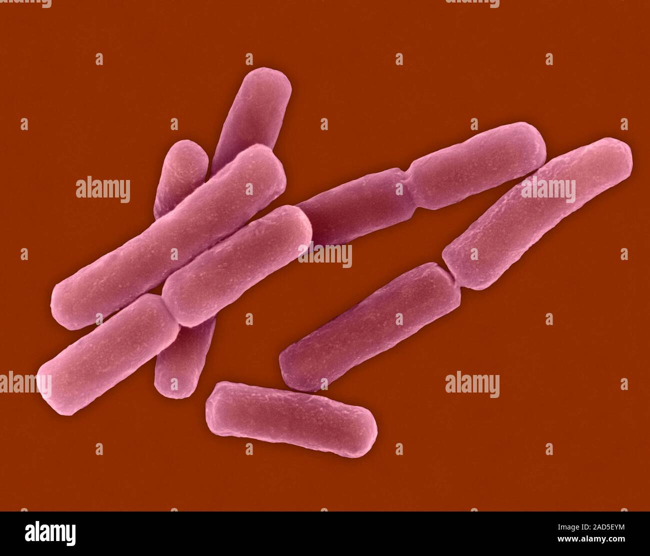 Coloured scanning electron micrograph (SEM) of Bacillus anthracis ...