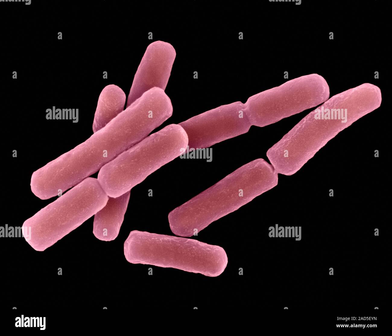 Coloured scanning electron micrograph (SEM) of Bacillus anthracis ...